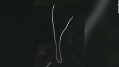 World's largest bacterium discovered is the size of a human eyelash ...