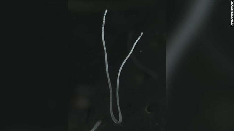 World's largest bacterium discovered is the size of a human eyelash ...